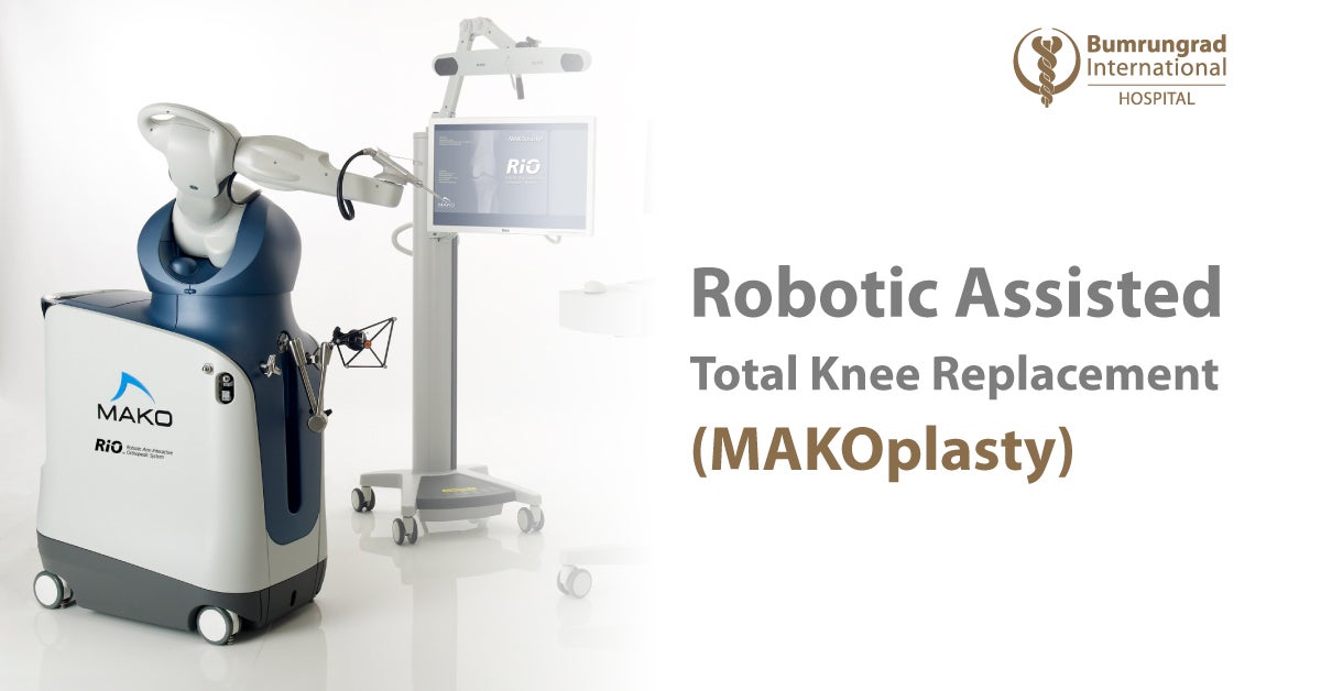 Robotic Assisted Total Knee Replacement (MAKOplasty)